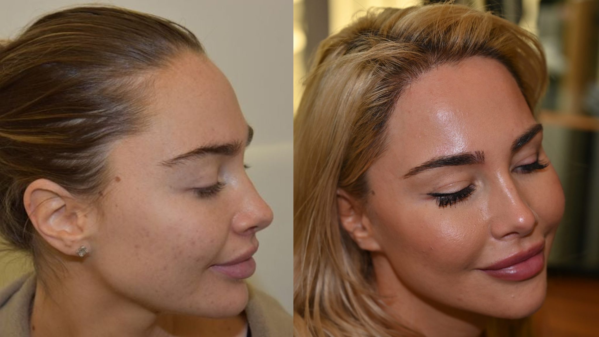 Hair Transplants UK: Hair Clinic In Harley Street - HS Hair