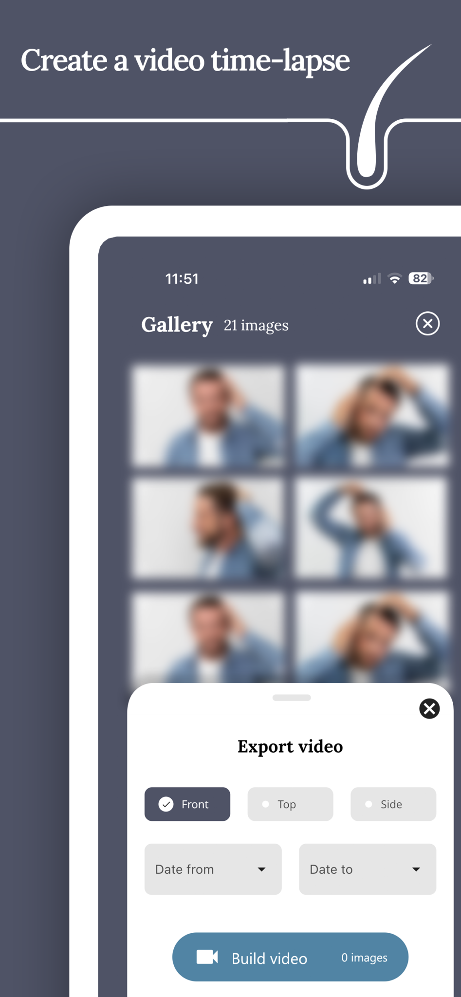 Hair Track App | Track Hair Loss | Harley Street Hair Clinic