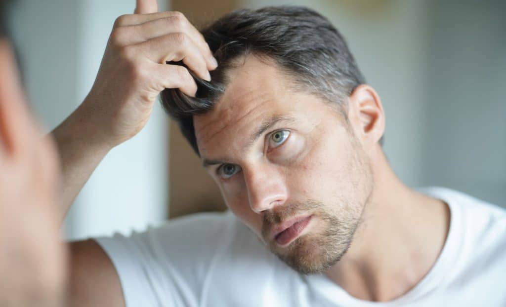 M-Shaped Hairlines: What's an M-Shaped Hairline?