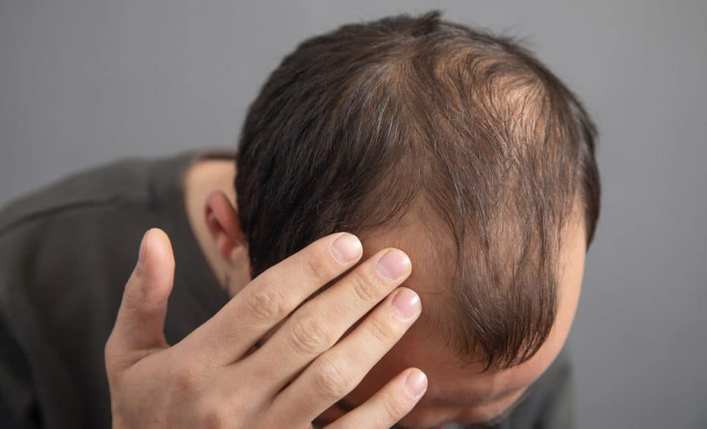Does Vaping Cause Hair Loss? Can Vaping Cause Hair Loss?